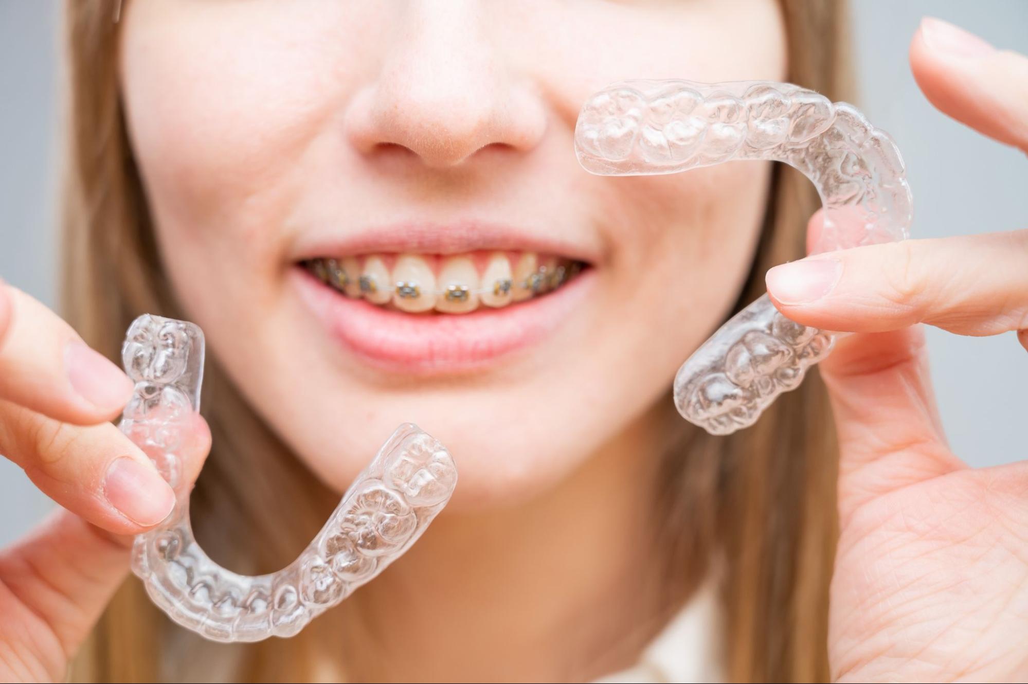 Do Braces or Invisalign Fit Your Lifestyle? | Rise + Smile Orthodontics